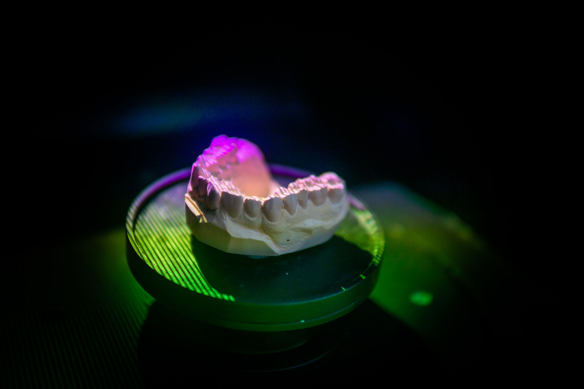 Empreinte numérique - SIVP DENTAIRE