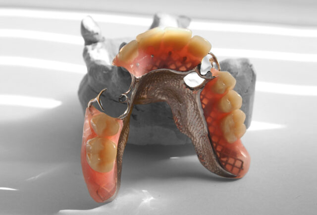 Stellite - SIVP DENTAIRE