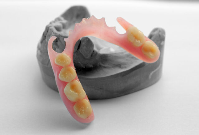 Prothèse amovible VALPLAST - SIVP DENTAIRE