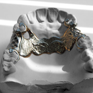 Stellite - SIVP DENTAIRE