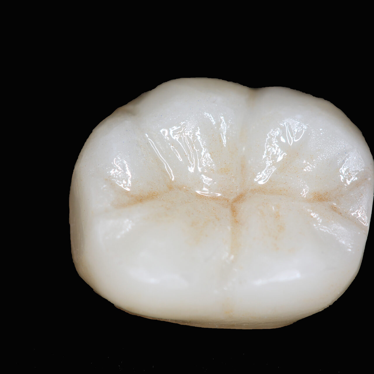 Couronne full zirone multicouche - SIVP DENTAIRE